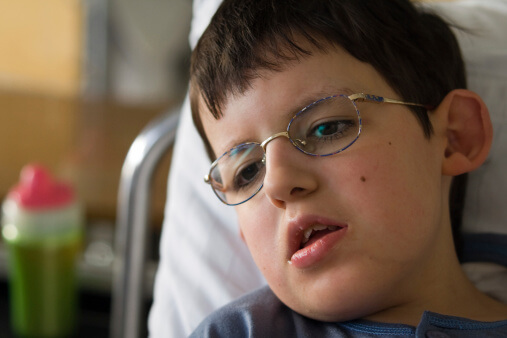 Carbon Monoxide Poisoning | DrGreene