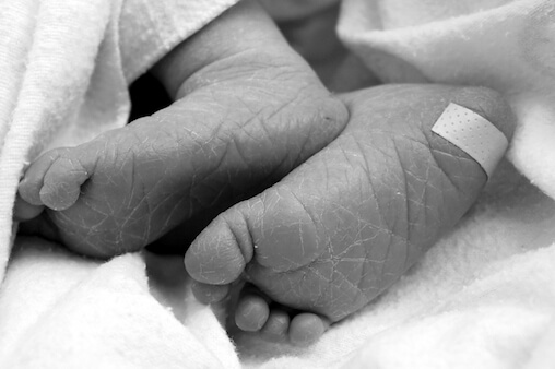 Congenital Hypothyroidism: A-to-Z Guide from Diagnosis to Treatment to ...