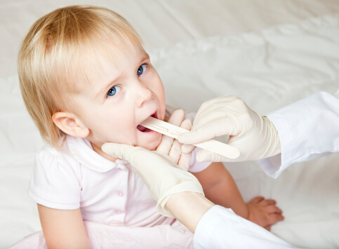 Tonsillitis A-to-Z Guide: Overview, Diagnosis, Treatment & Prevention ...
